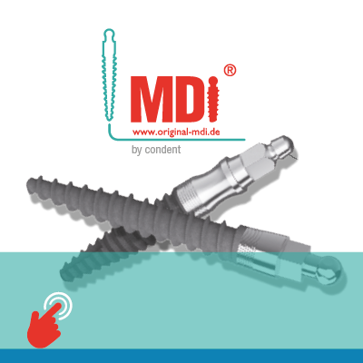 condent Implantate – Implantat Plattform für alle Indikationen